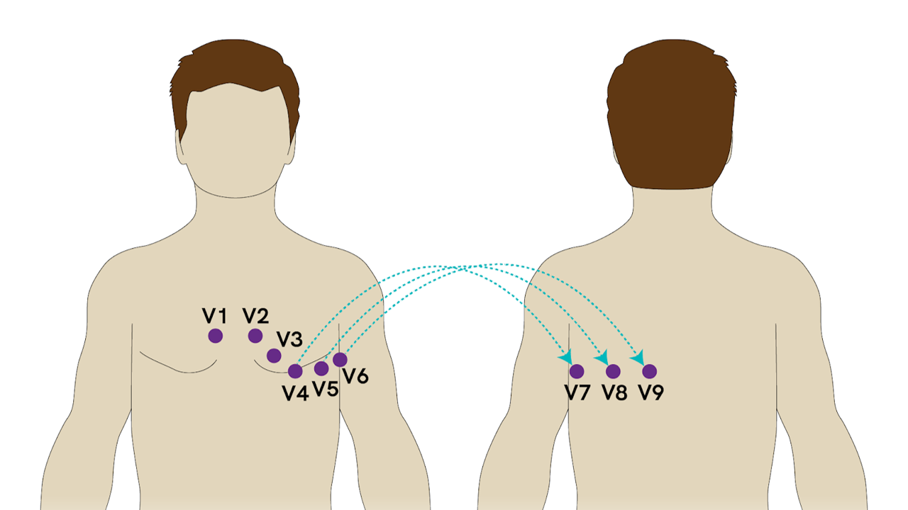 UMEM Educational Pearls - University of Maryland School of Medicine, Department of Emergency ...